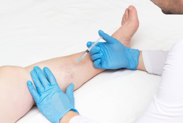 Laser Surgery for Varicose Veins in Nigdi | Quick & Painless Treatment